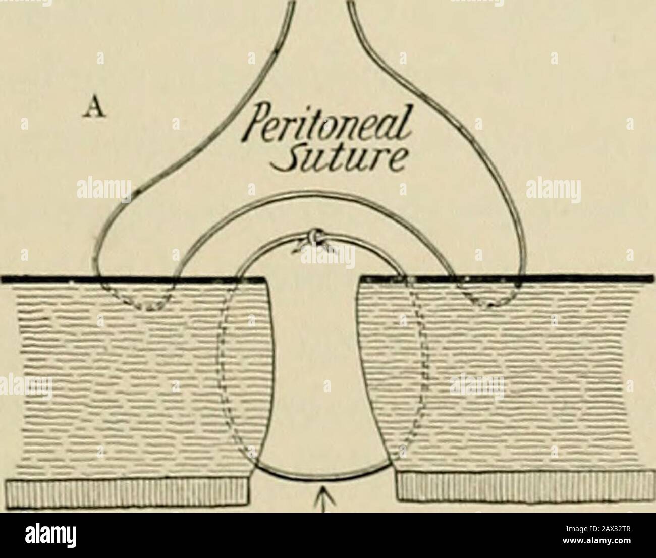 The American text-book of obstetrics for practitioners and students ...