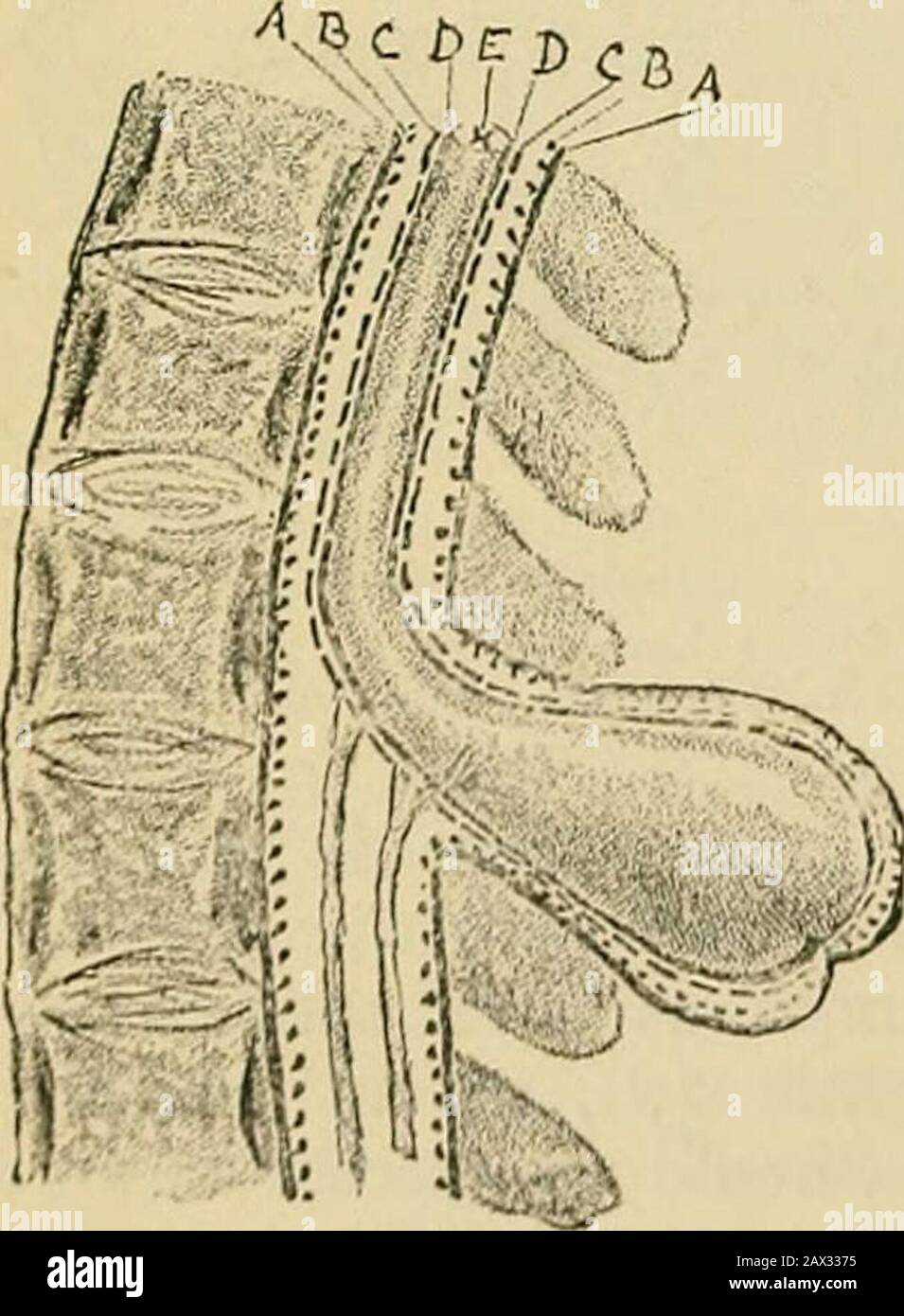 Surgery; its theory and practice . & syringo-myelocele (Fig. 281),the ...