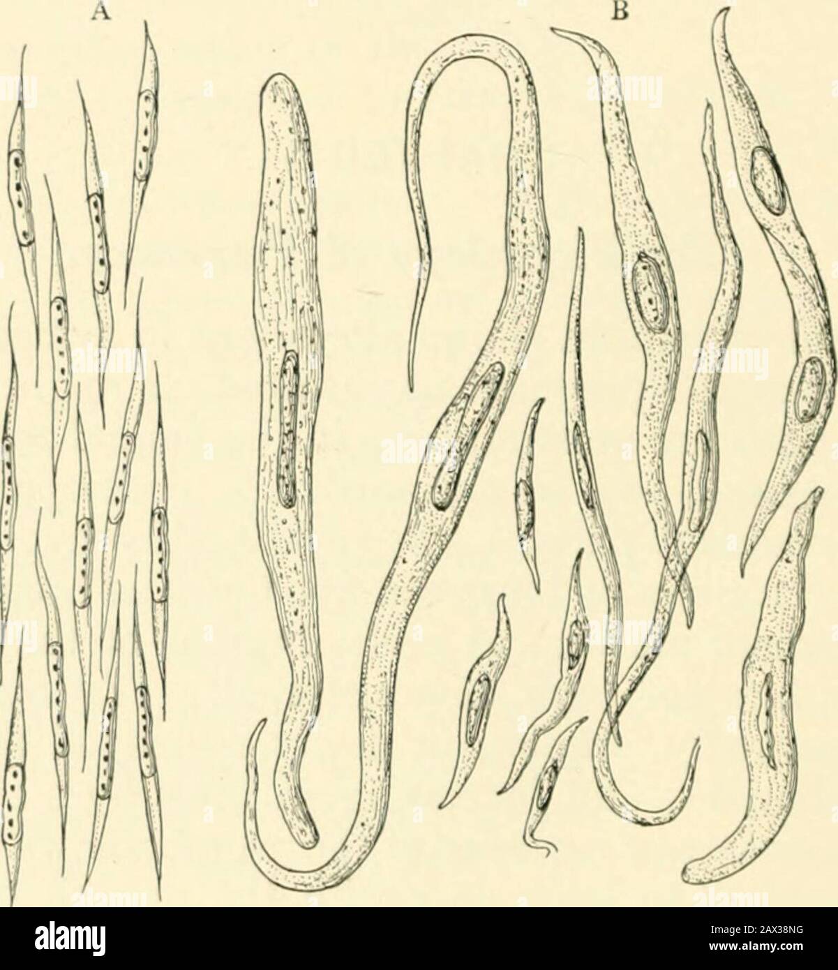 Uterine muscle hi-res stock photography and images - Alamy