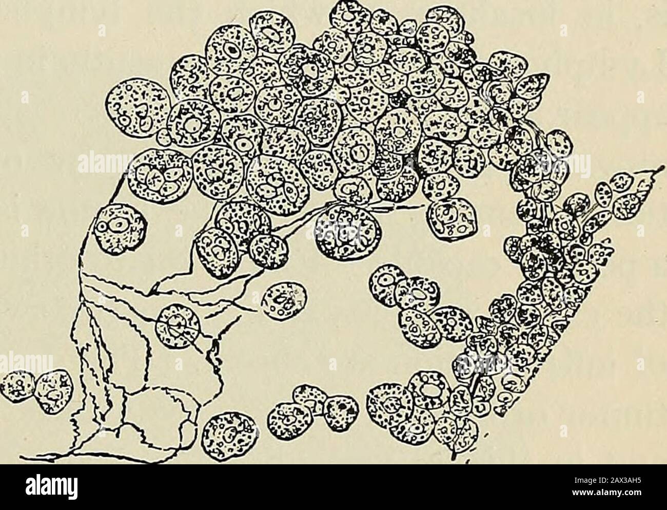 The pathology and surgical treatment of tumors . le of the tumor is ...