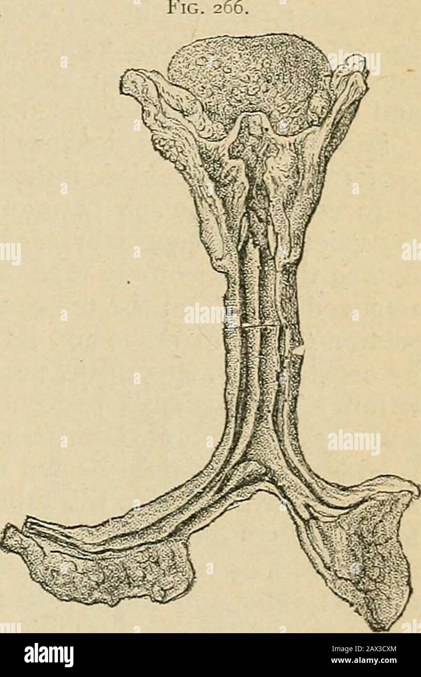 Thedisease hi-res stock photography and images - Alamy