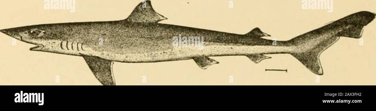 Placental attachment hi-res stock photography and images - Alamy