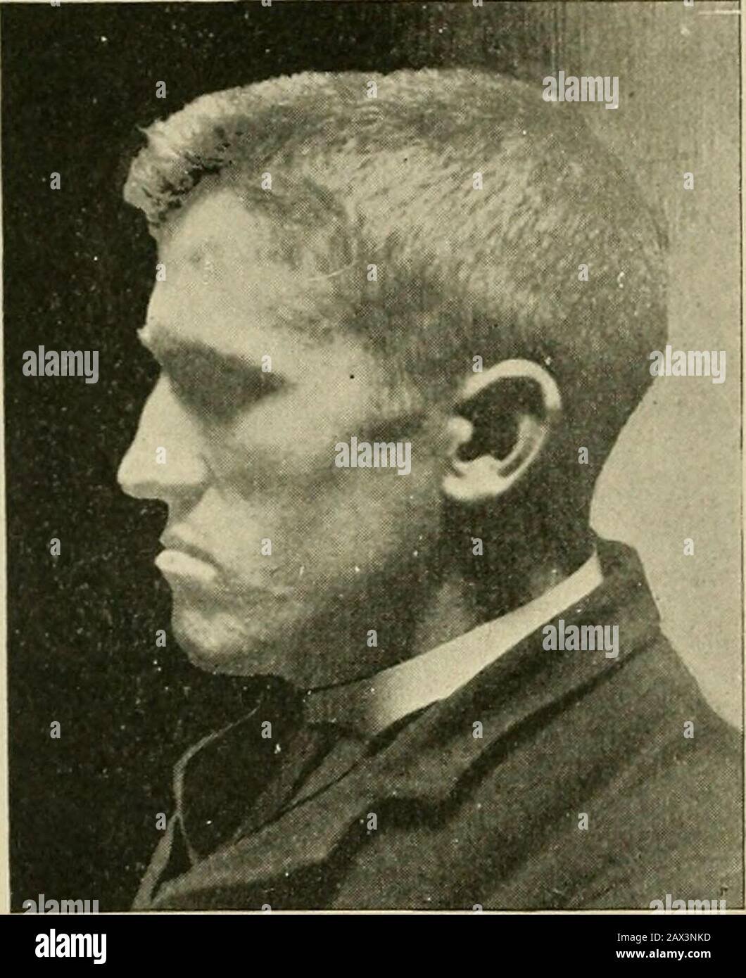 Alveolar process of maxilla hi-res stock photography and images - Alamy
