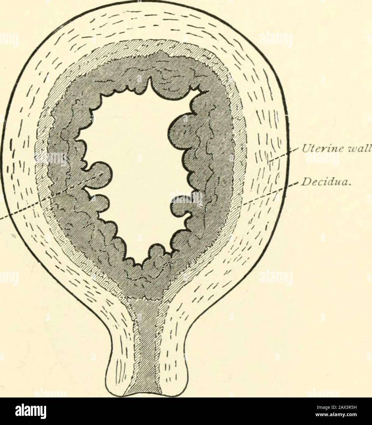 Pre vascular hi-res stock photography and images - Alamy