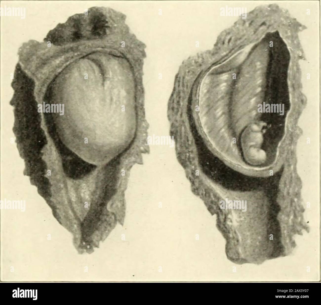 Uterine muscle hi-res stock photography and images - Alamy