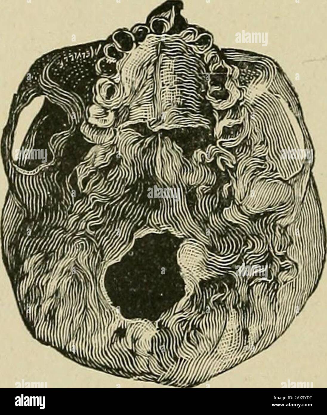 Alveolar process of maxilla hi-res stock photography and images - Alamy