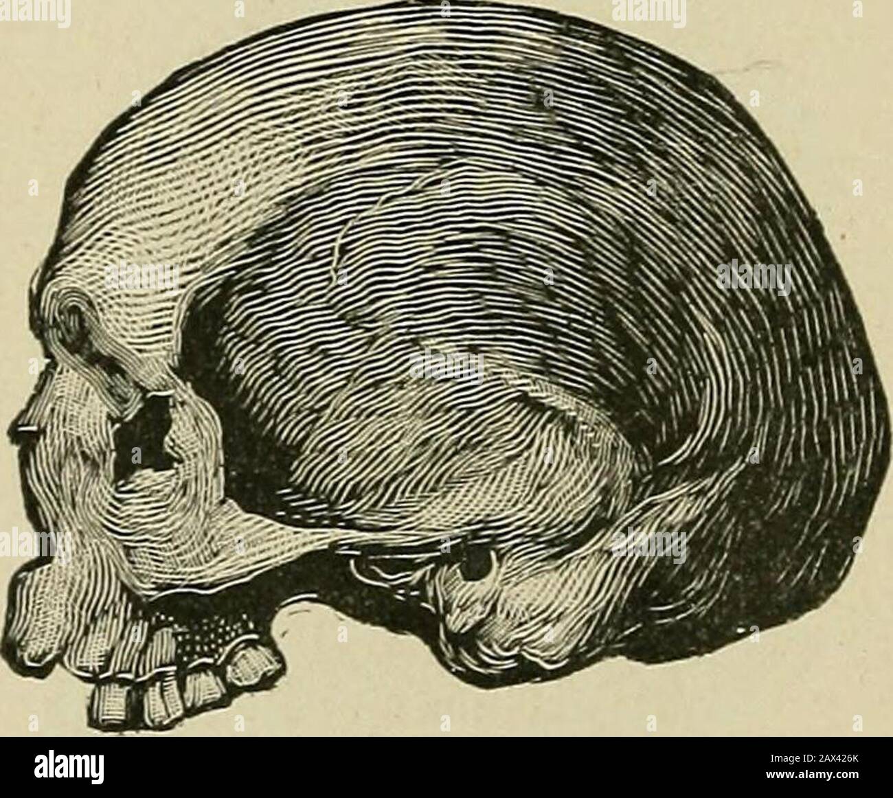 Dolichocephalic hi-res stock photography and images - Alamy