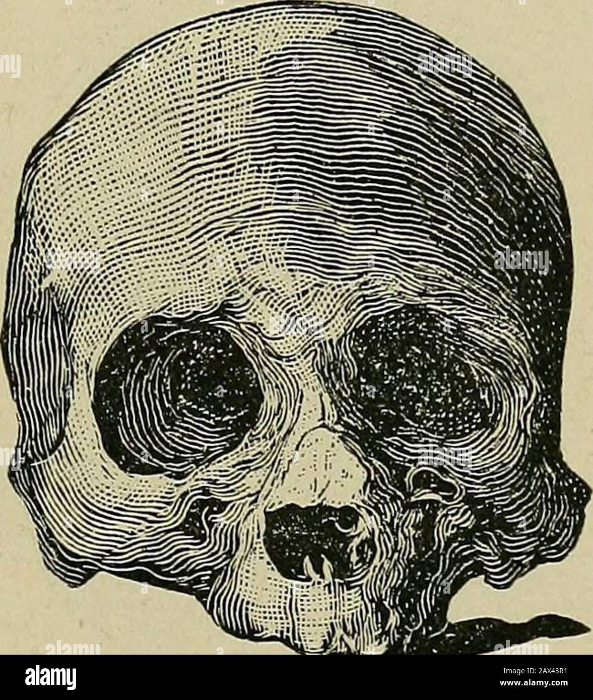 The etiology of osseous deformities of the head, face, jaws and teeth ...