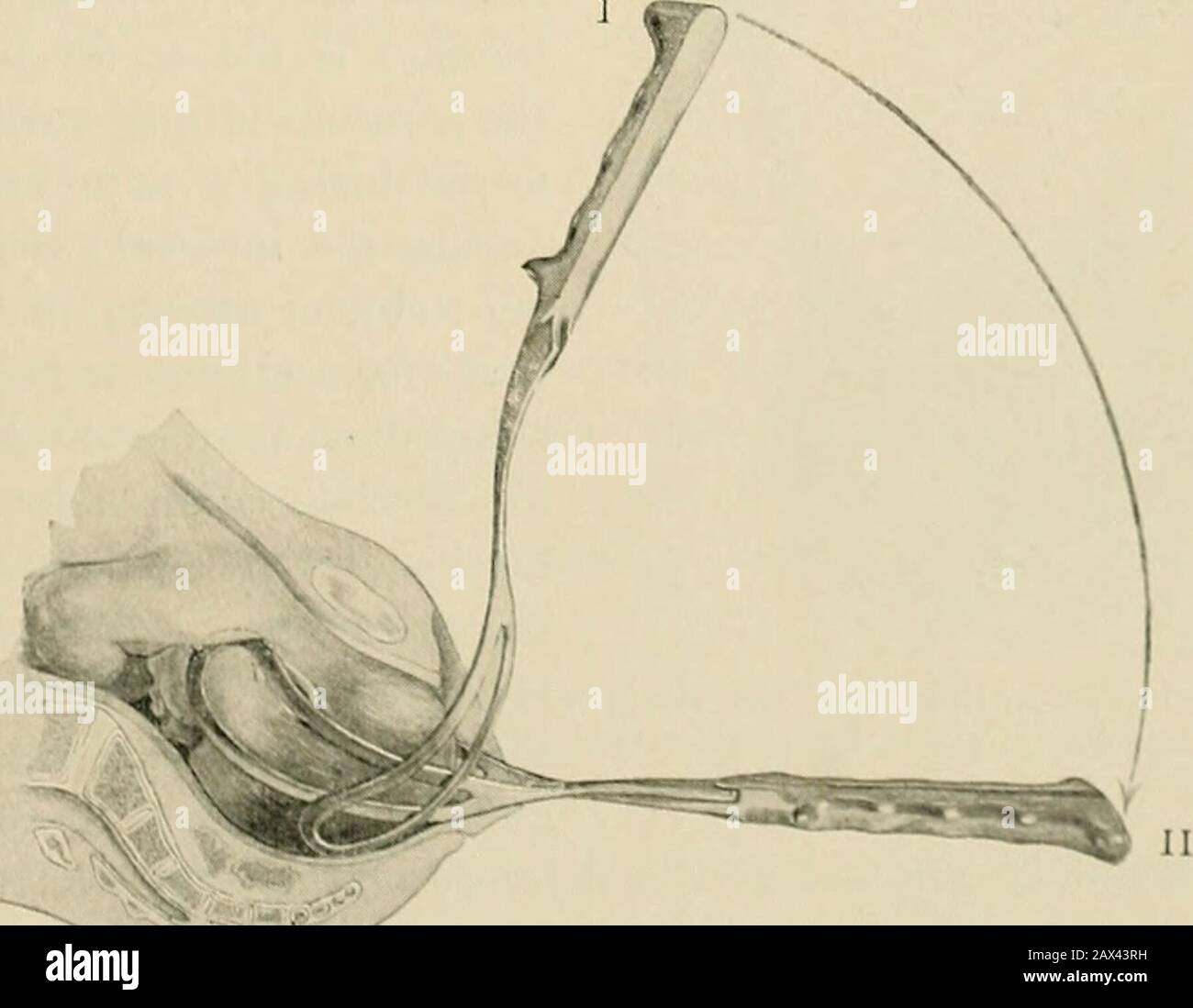 Uterus lateral view hi-res stock photography and images - Alamy