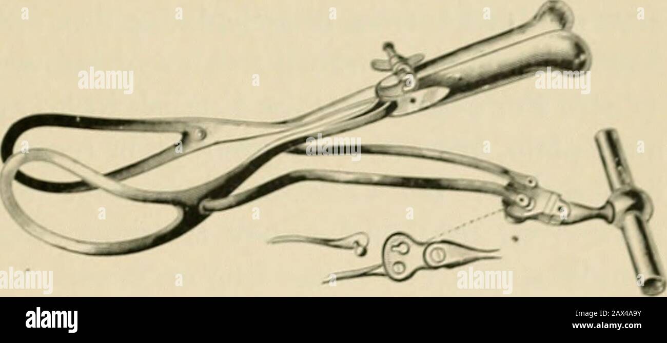 The American text-book of obstetrics for practitioners and students ...