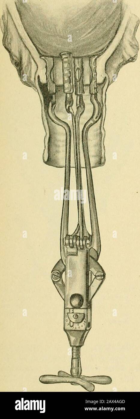The practice of obstetrics, designed for the use of students and ...