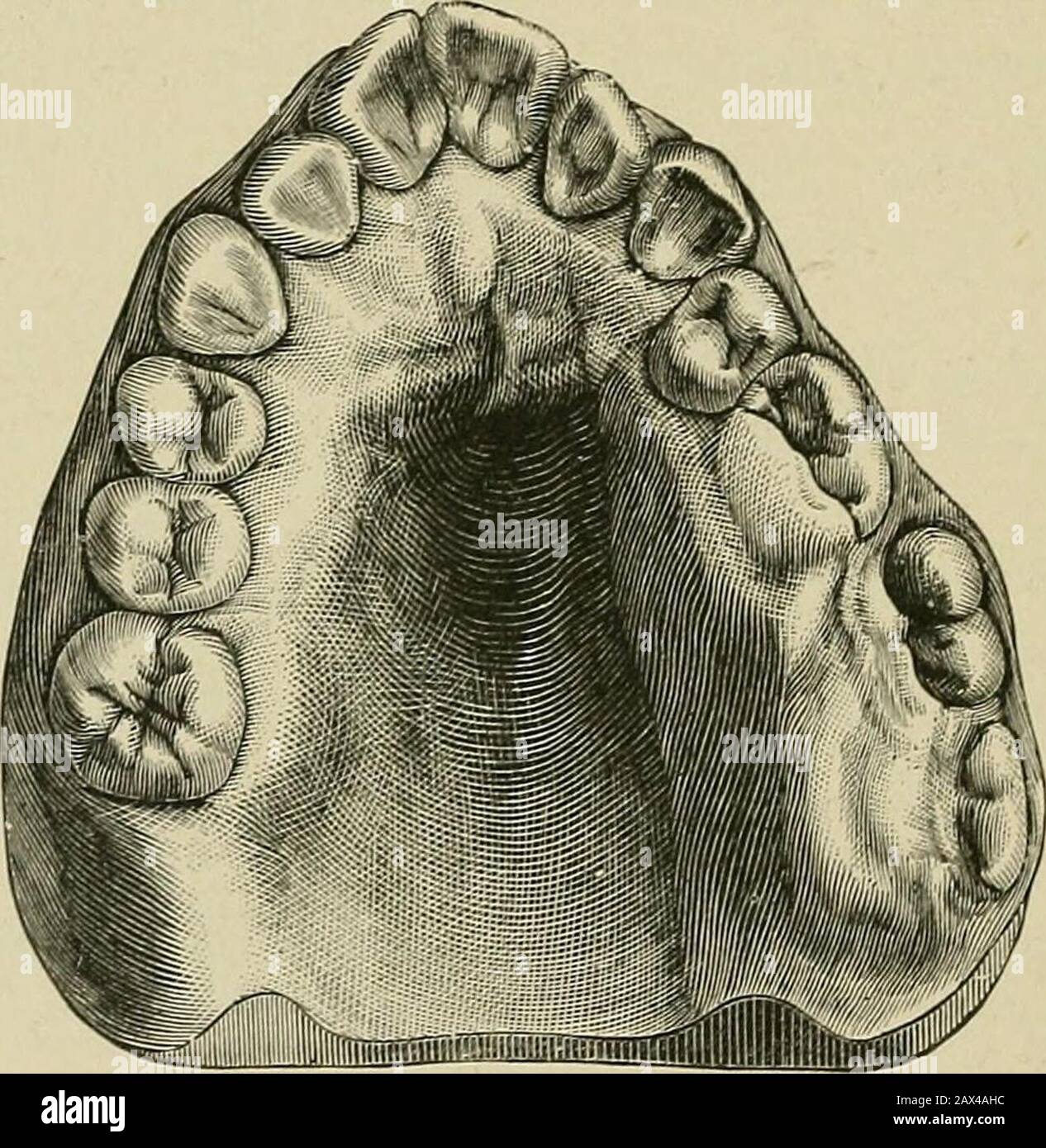 The etiology of osseous deformities of the head, face, jaws and teeth ...
