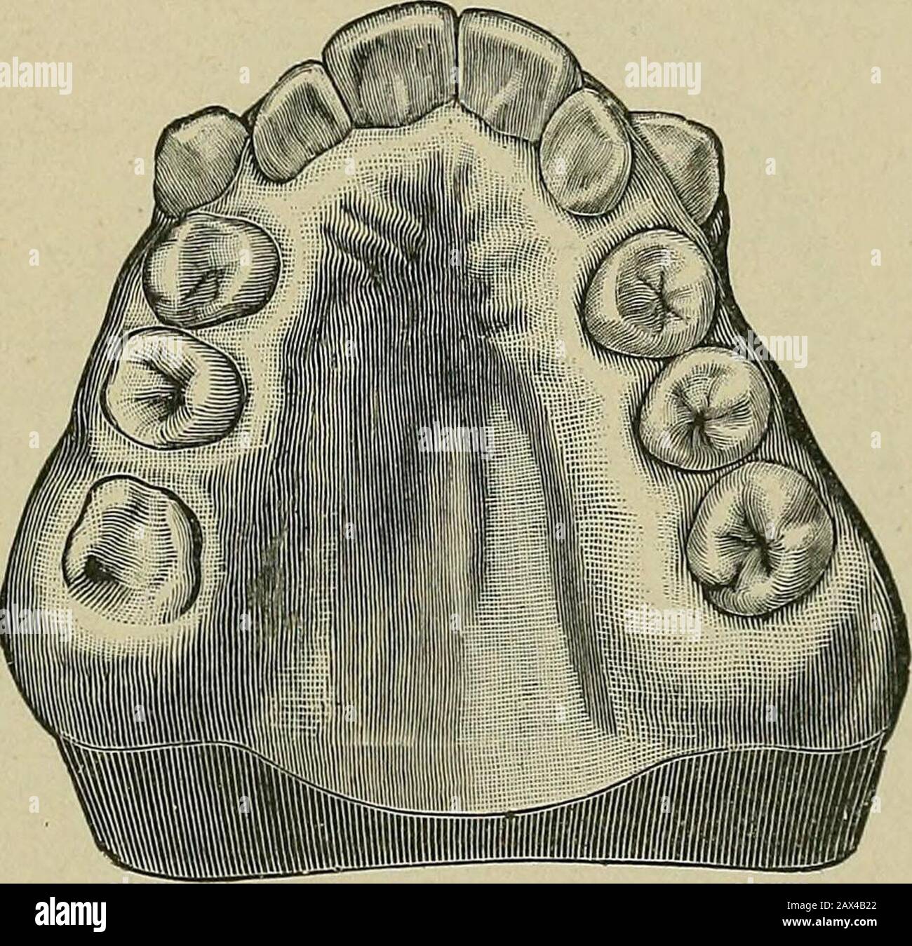 The etiology of osseous deformities of the head, face, jaws and teeth ...