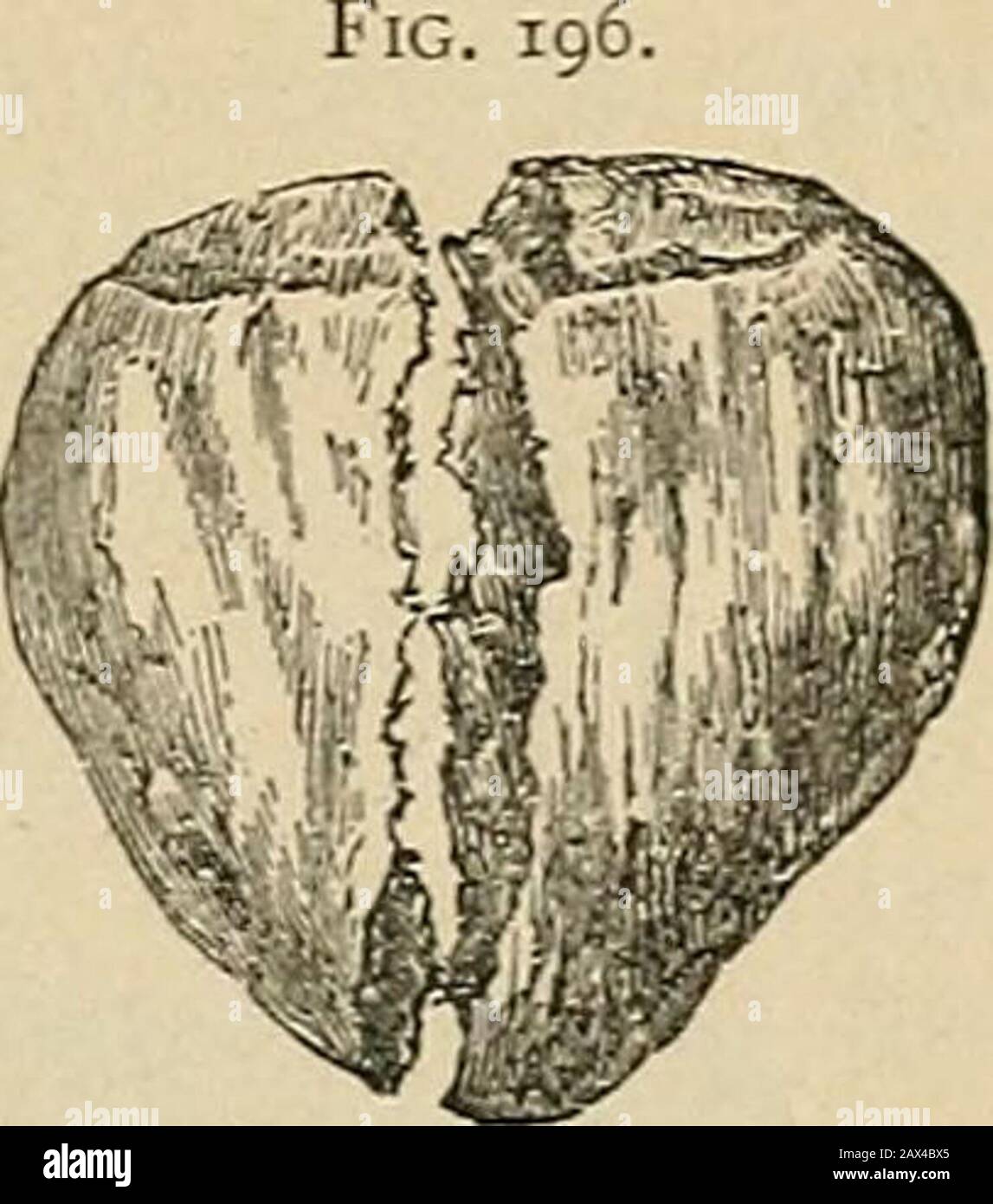 Surgery; its theory and practice . Fig. 197. Transverse and vertical ...