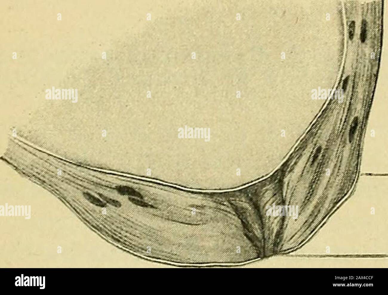 Lithotomy position hi-res stock photography and images - Alamy