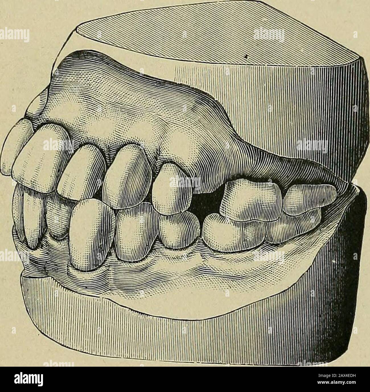 Alveolar bones hi-res stock photography and images - Alamy
