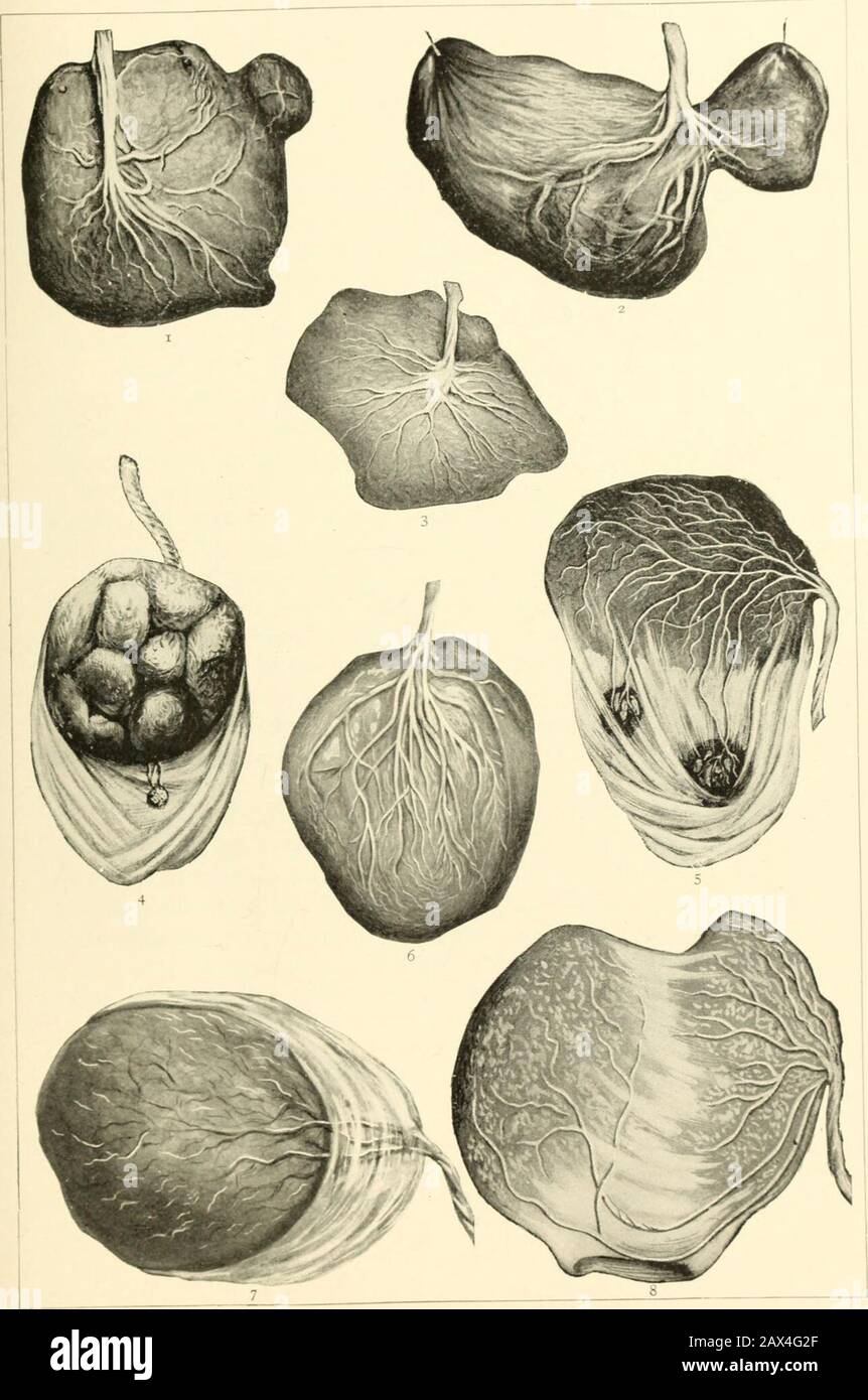 A textbook of obstetrics . j