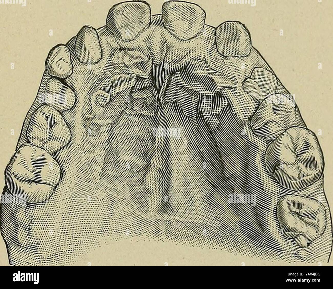 The etiology of osseous deformities of the head, face, jaws and teeth ...