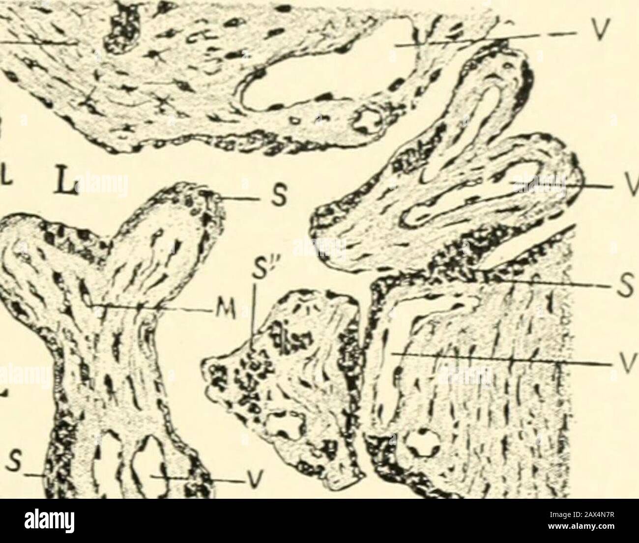 A textbook of obstetrics . Fig. 87.— Section oi placenta, showing villi ...