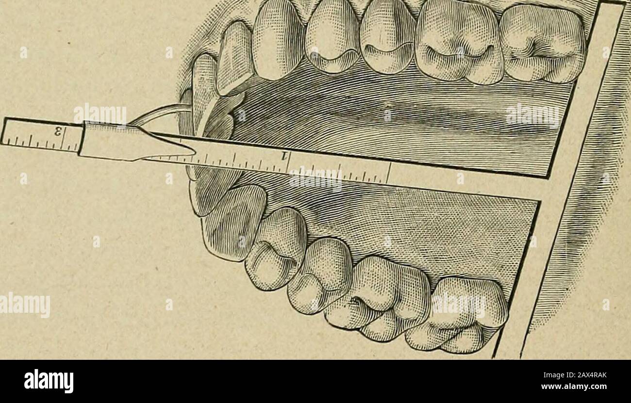 Persons Jaw Falling Out Clifford Chance Names New London Managing