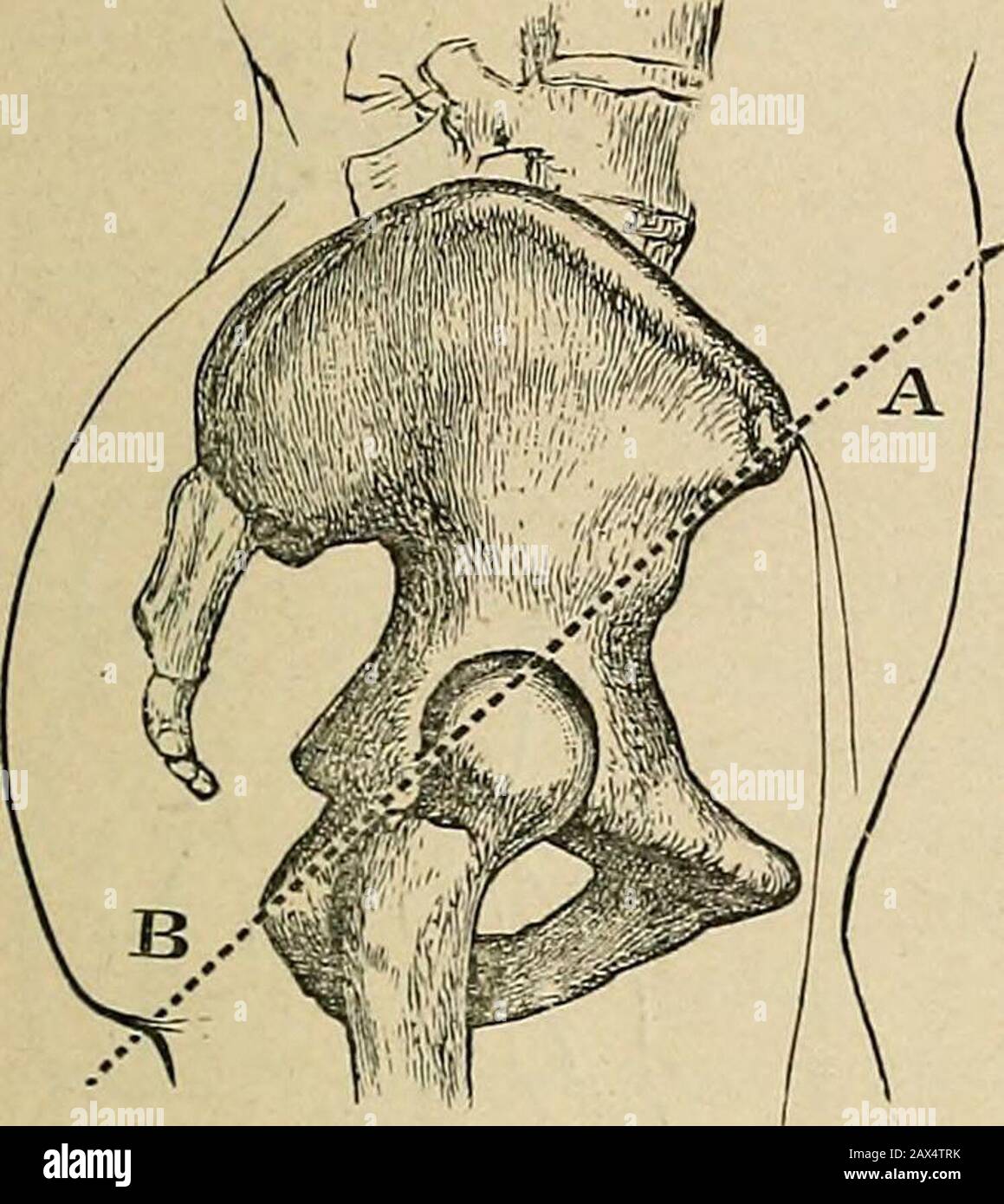 Sciatic notch hi-res stock photography and images - Alamy