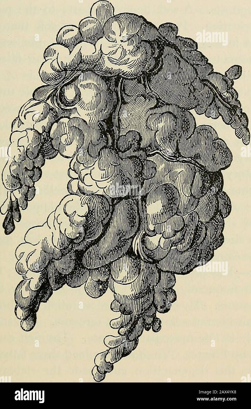 The pathology and surgical treatment of tumors . -sule is perfect in ...