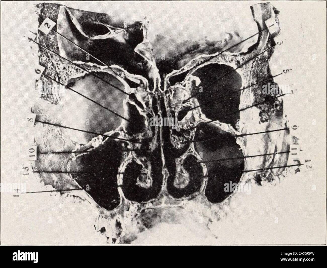 National Eclectic Medical Association quarterly . Plate VII.—Transverse ...