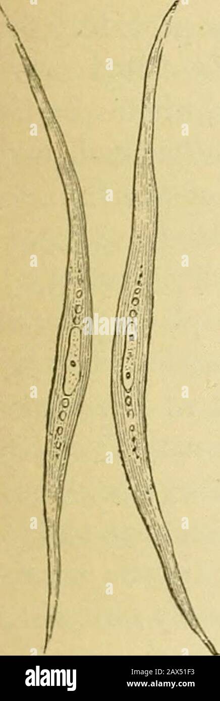 Dense muscle layers hi-res stock photography and images - Alamy