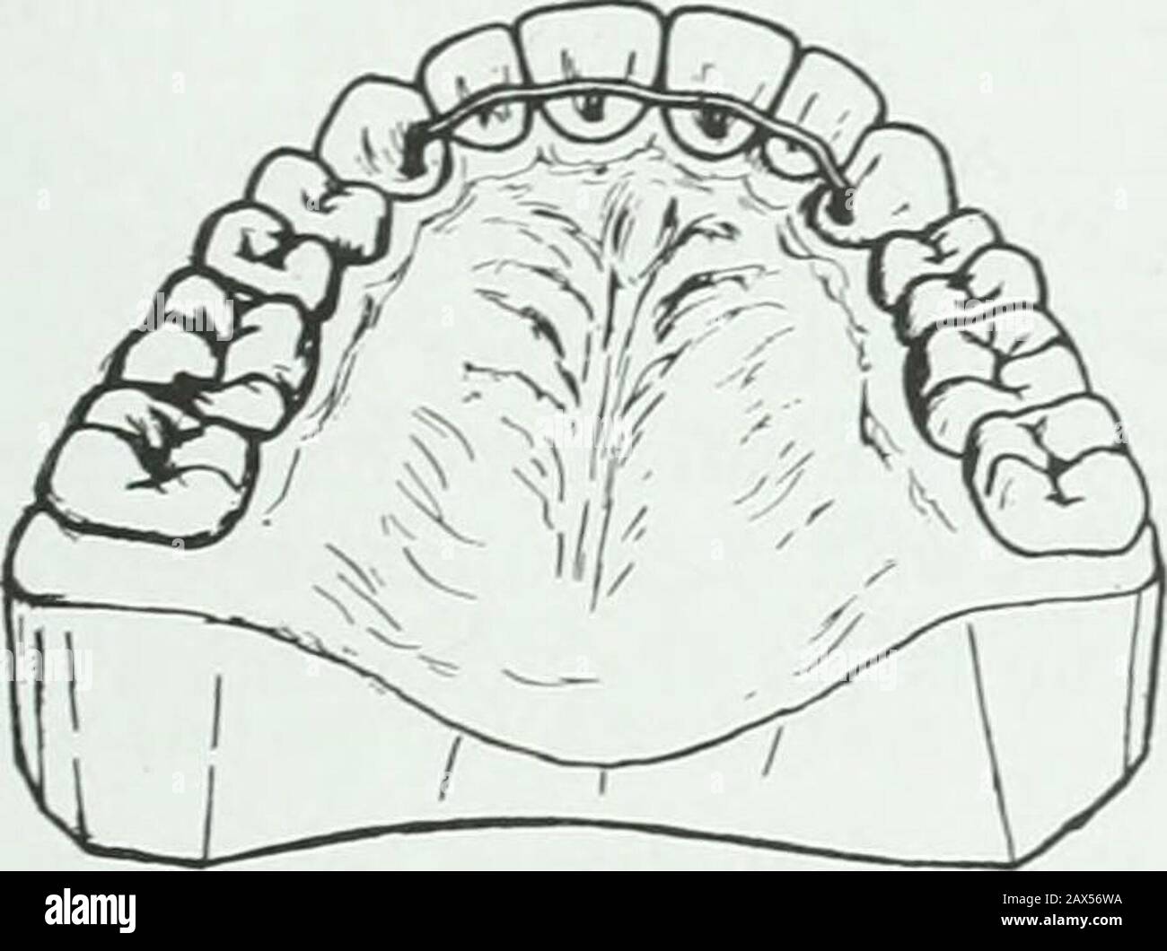 Dental modification hi-res stock photography and images - Alamy