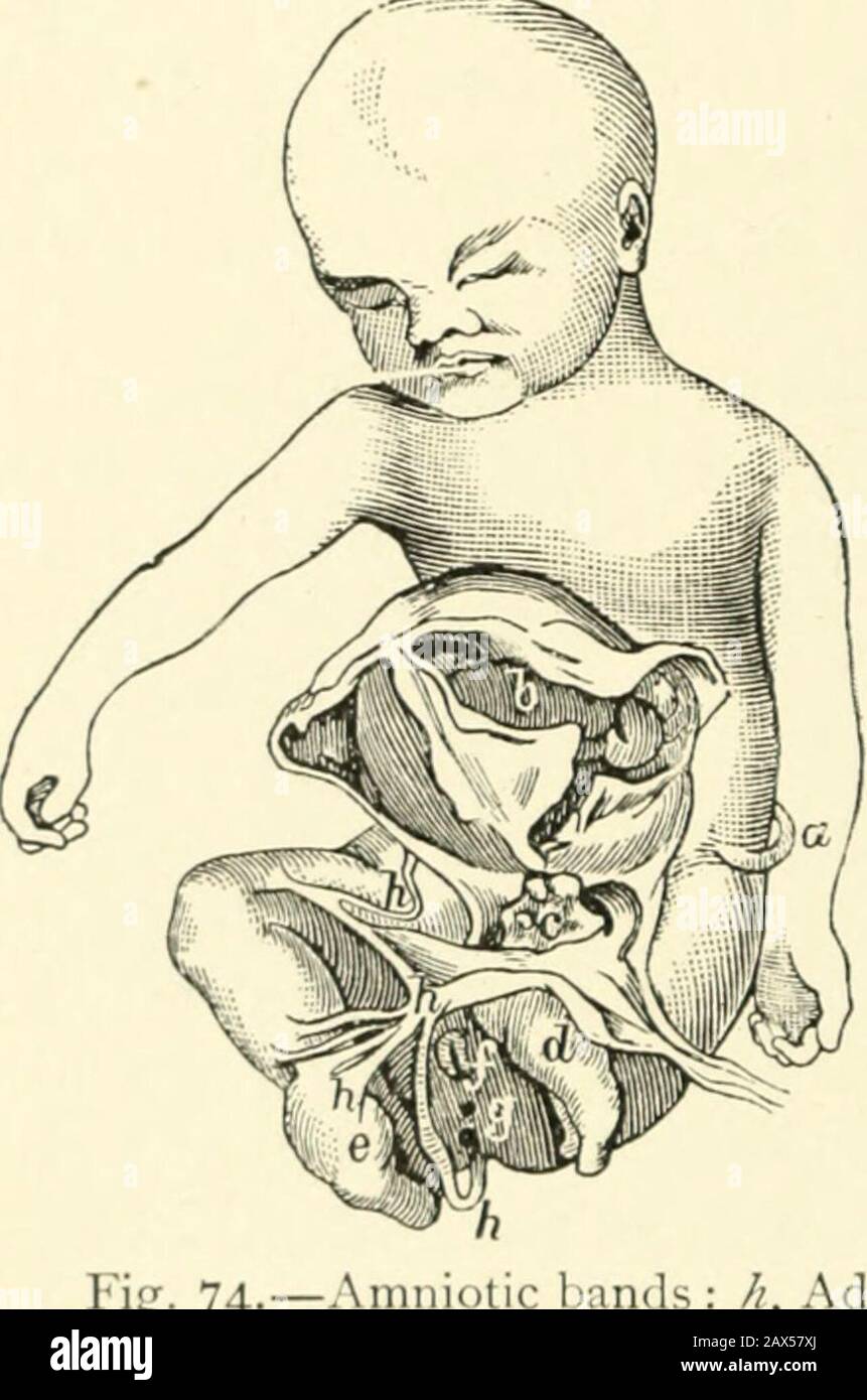 Fetal movements hi-res stock photography and images - Alamy