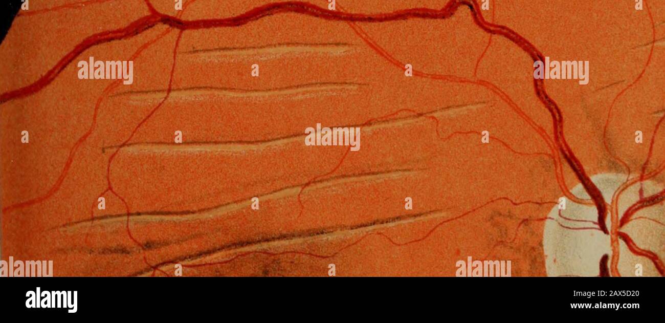 Transactions . ,v V.V-at .J^ewmaii j& C? chroiao .iith PECULIAR LINES ...
