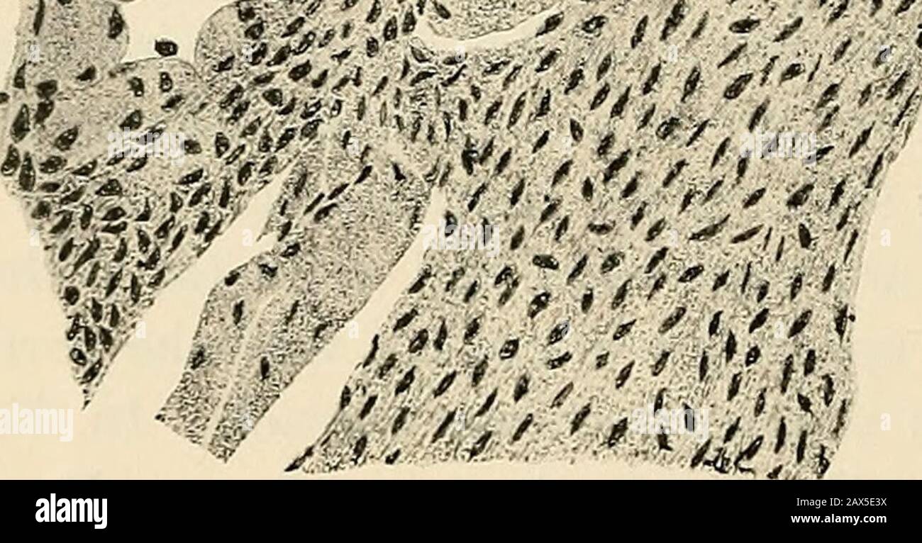 Peritoneal cavity hi-res stock photography and images - Alamy