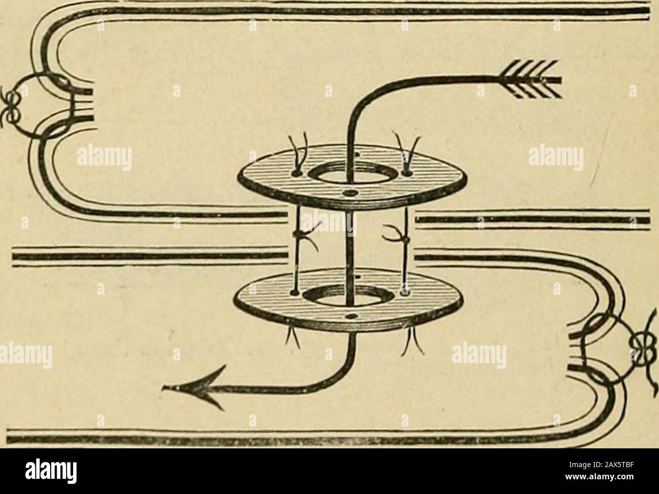 Surgery; its theory and practice . Method of forming an intestinal ...