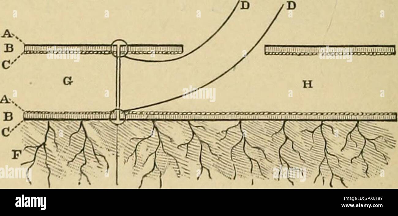 Surgery; its theory and practice . and at the sametime invaginate the ...