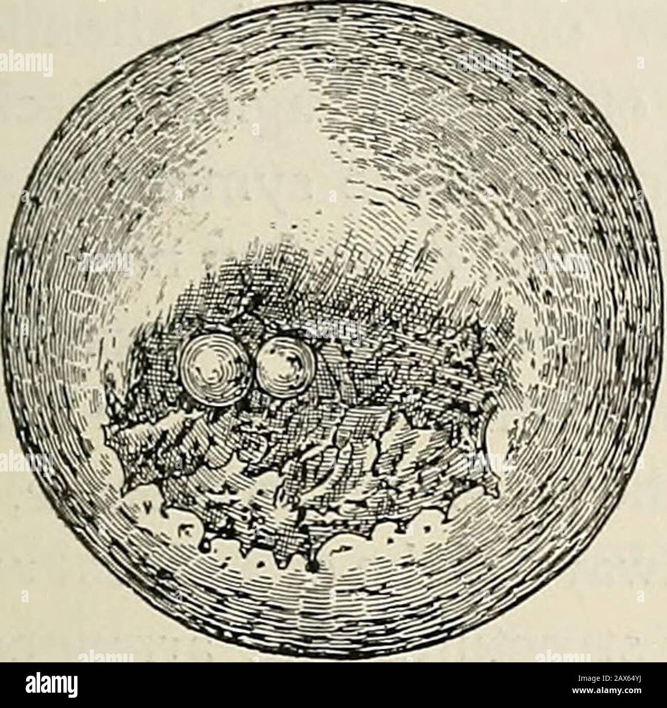 Cervical ring hi-res stock photography and images - Alamy