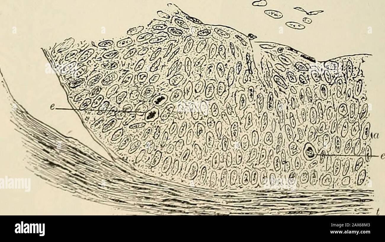 The pathology and surgical treatment of tumors . FiG. 236.—Primary ...