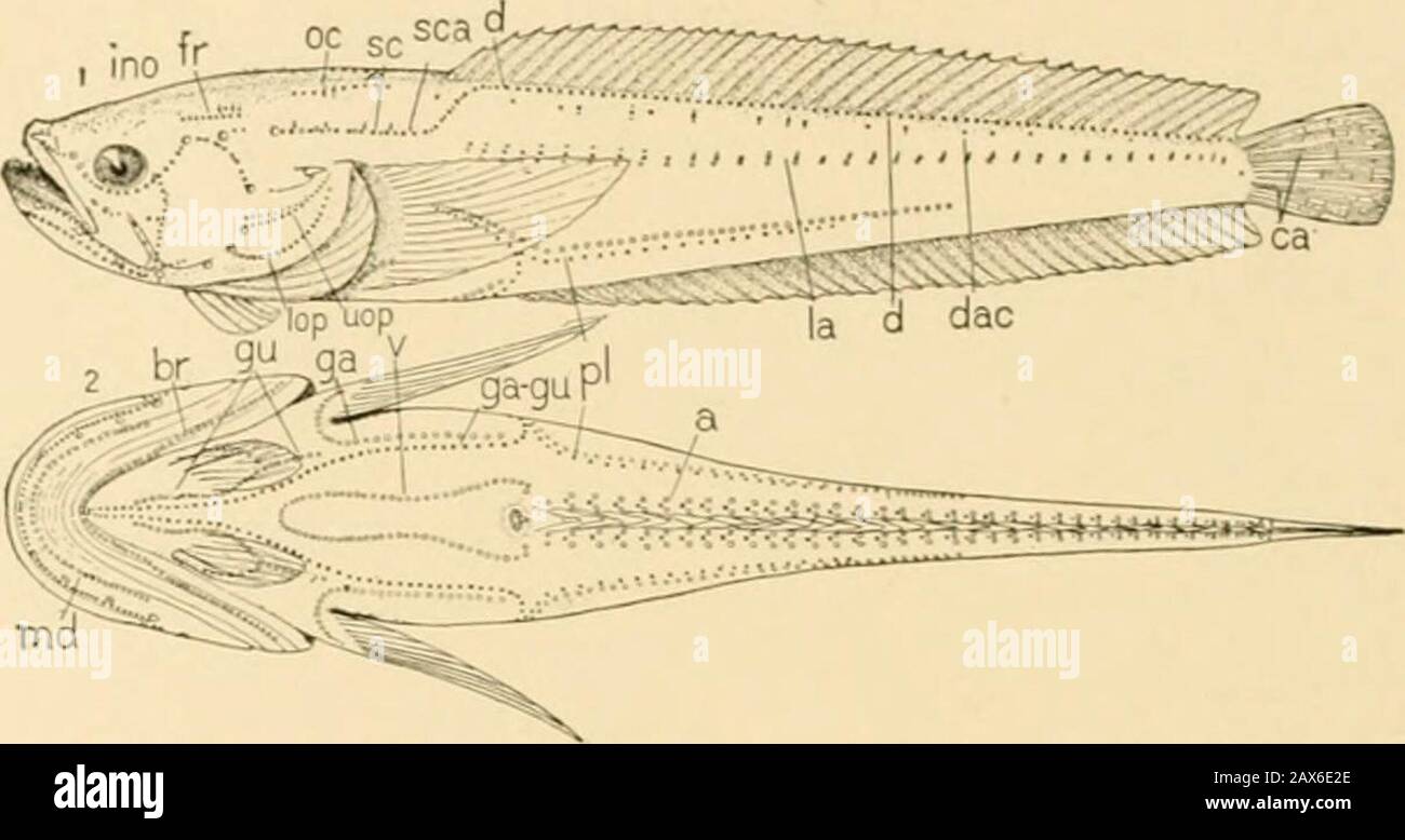 Spinal cord stimulation system hi-res stock photography and images - Alamy