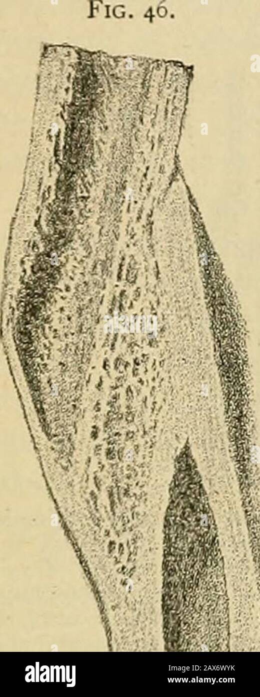 Simple fracture hi-res stock photography and images - Alamy