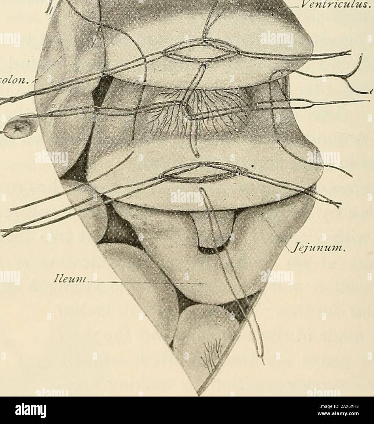 The pathology and surgical treatment of tumors . FiG. 211.—Moist ...