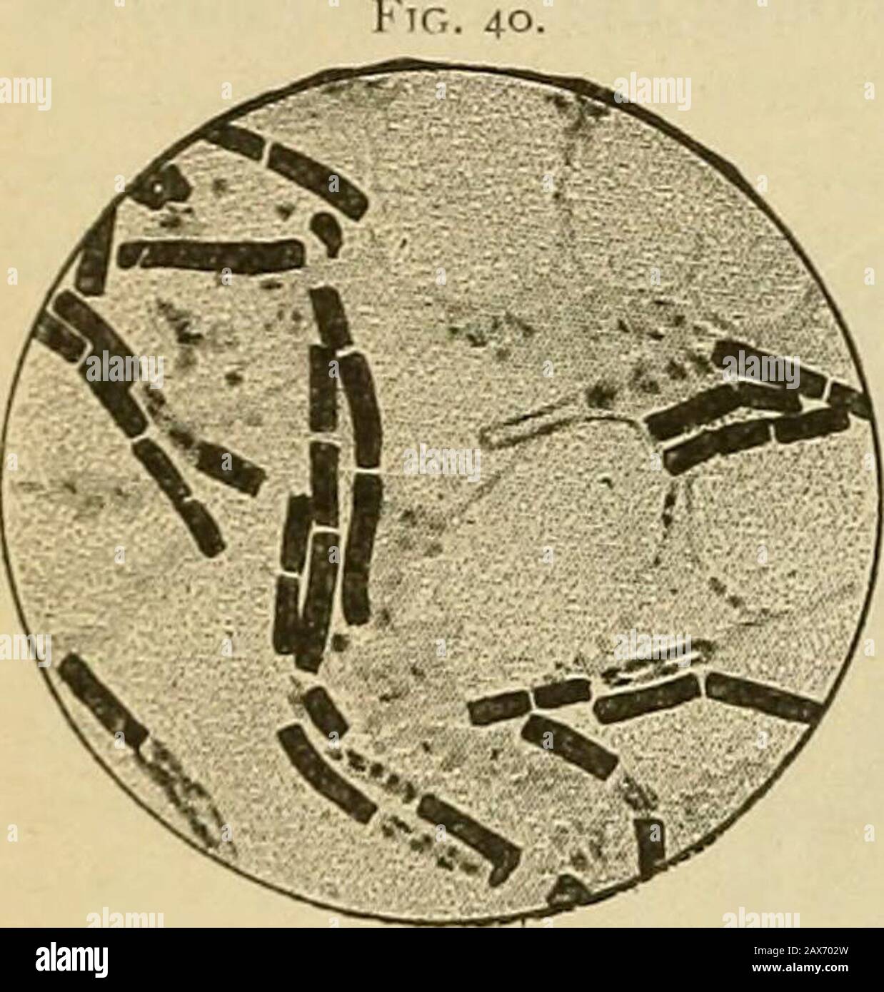 Actinomyces hi-res stock photography and images - Alamy