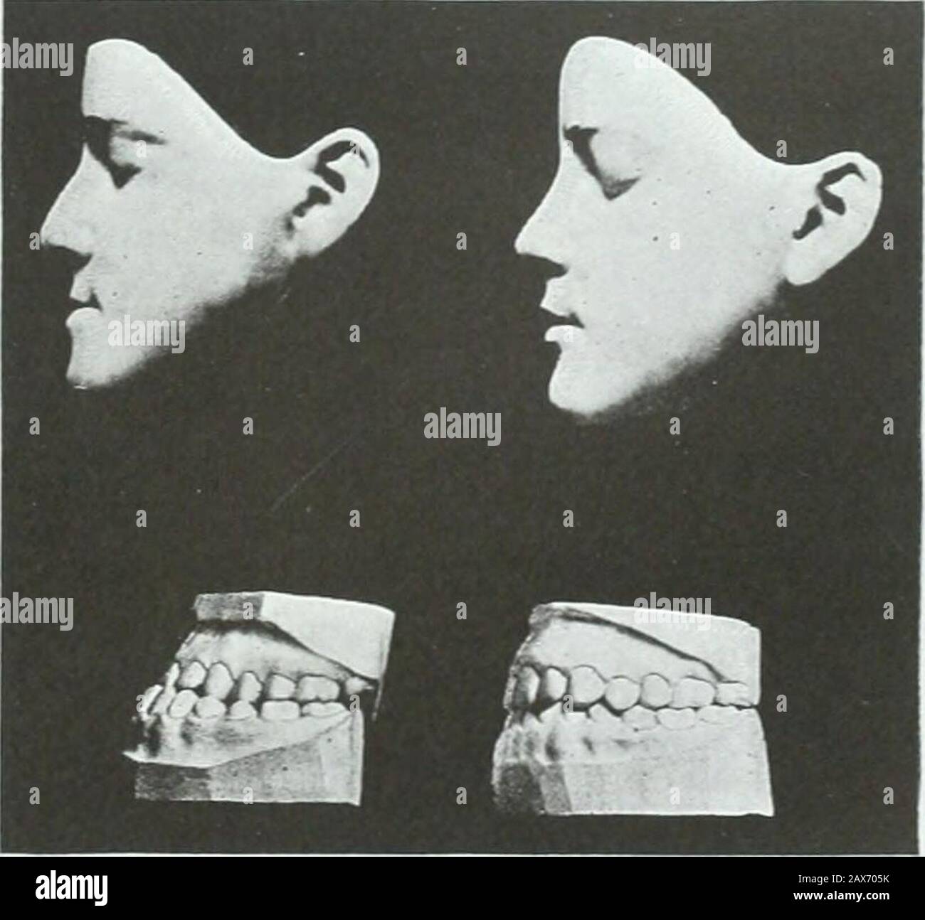 Disto hi-res stock photography and images - Alamy