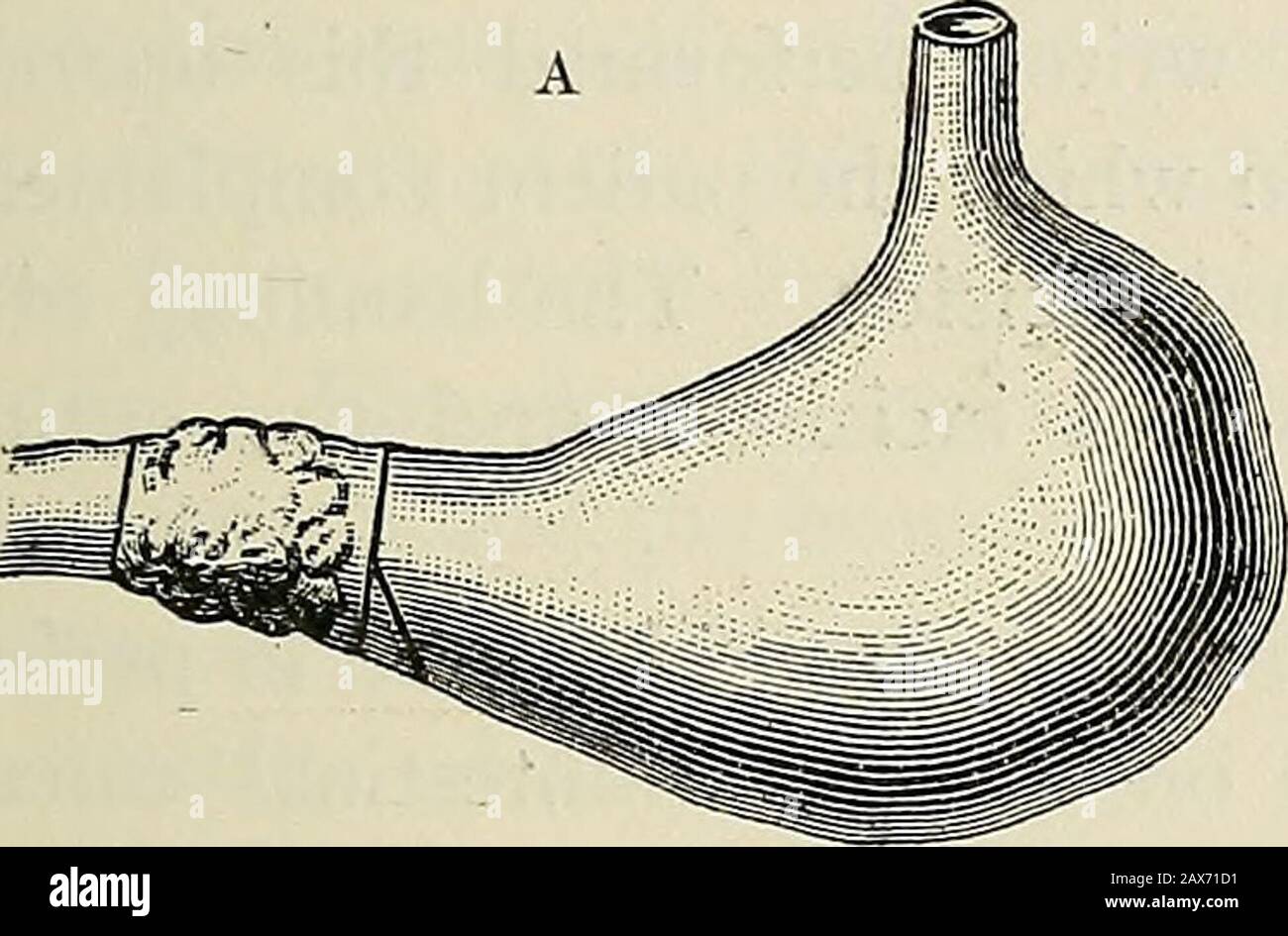 Closing The Incision High Resolution Stock Photography and Images - Alamy