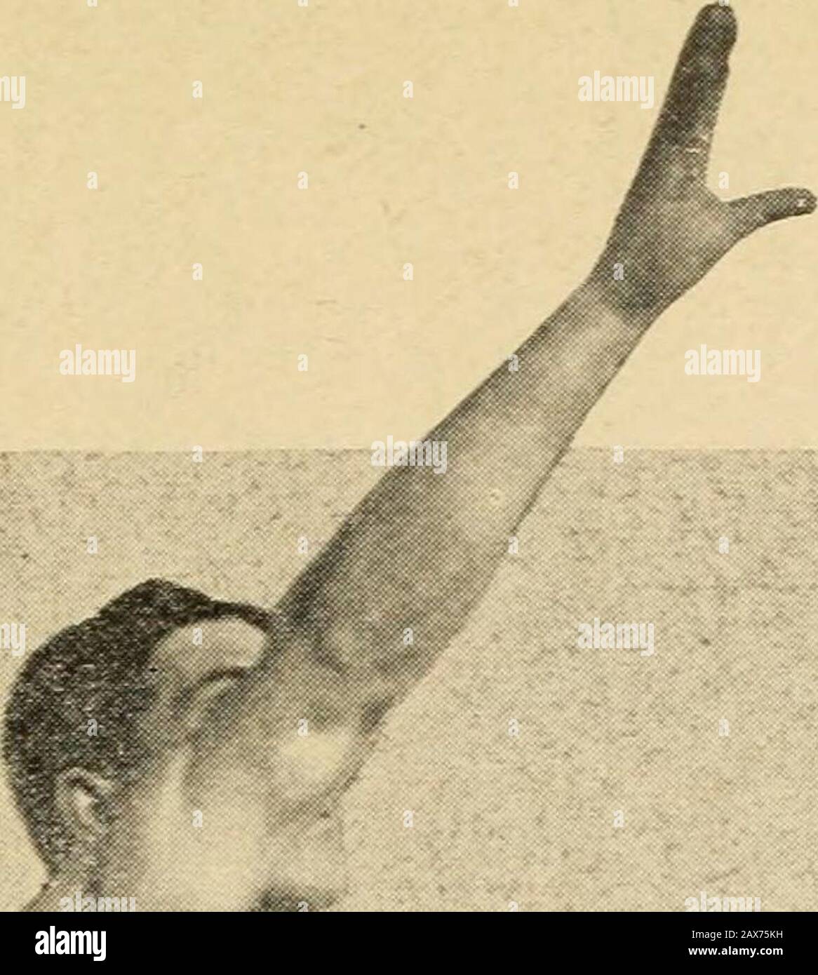 Arm leg extend exercise hi-res stock photography and images - Alamy