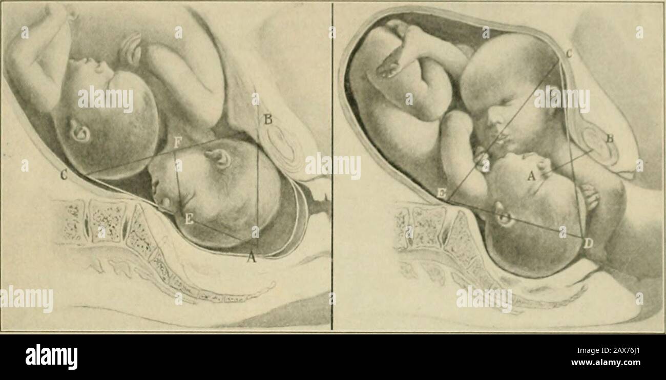 25 7 86 hi-res stock photography and images - Alamy