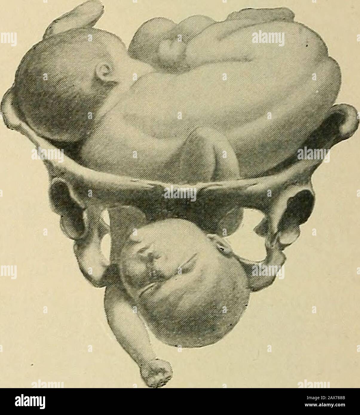 The American text-book of obstetrics for practitioners and students ...