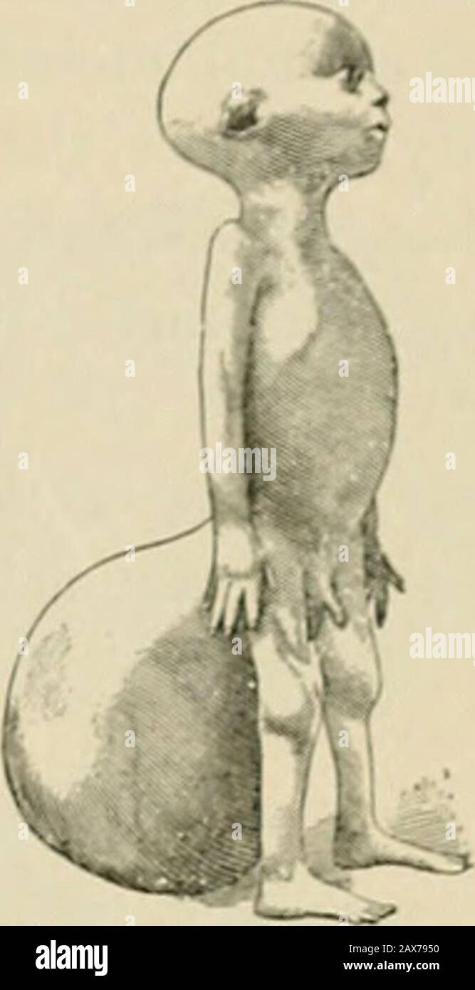 The American text-book of obstetrics for practitioners and students ...