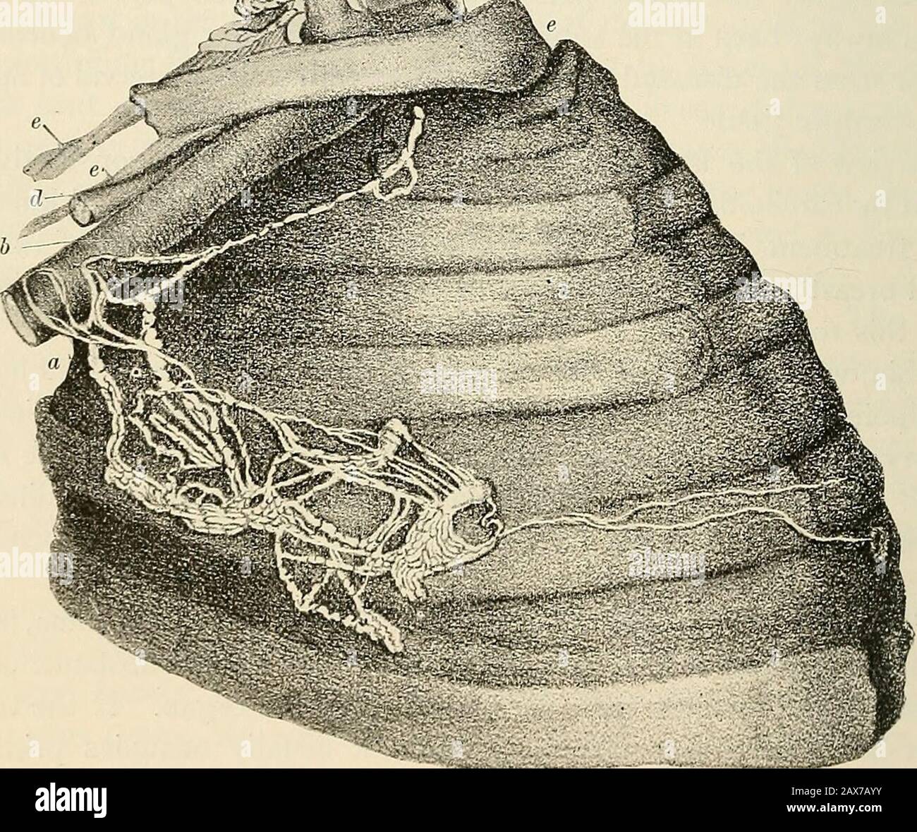 Skin traction hi-res stock photography and images - Alamy