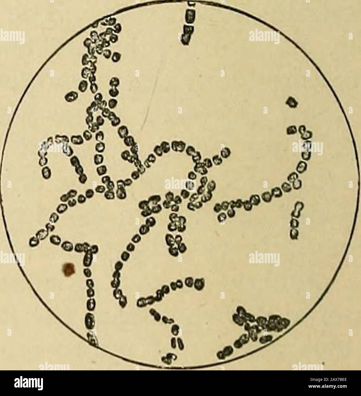 Surgery; its theory and practice . Staphylococci. • 950.(After ...