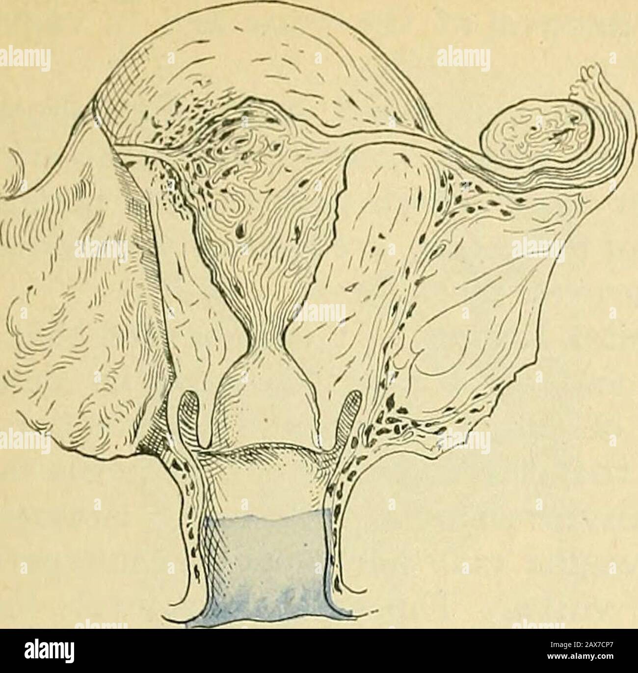 The practice of obstetrics, designed for the use of students and ...