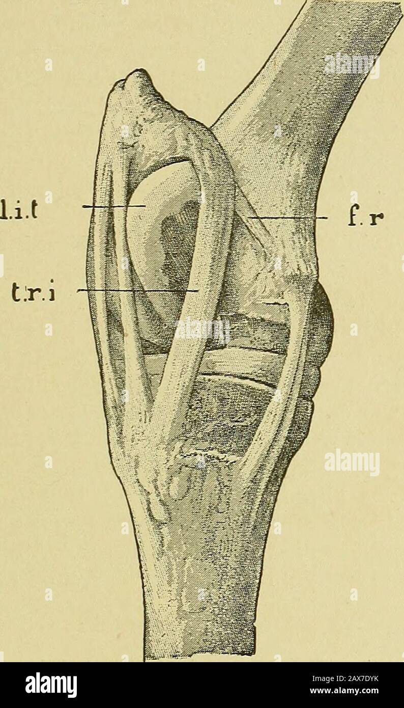 Neurectomy hi-res stock photography and images - Alamy
